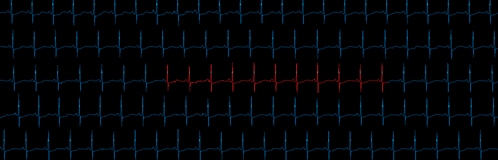 Create a highlight interaction in a training simulation - help - eLearning