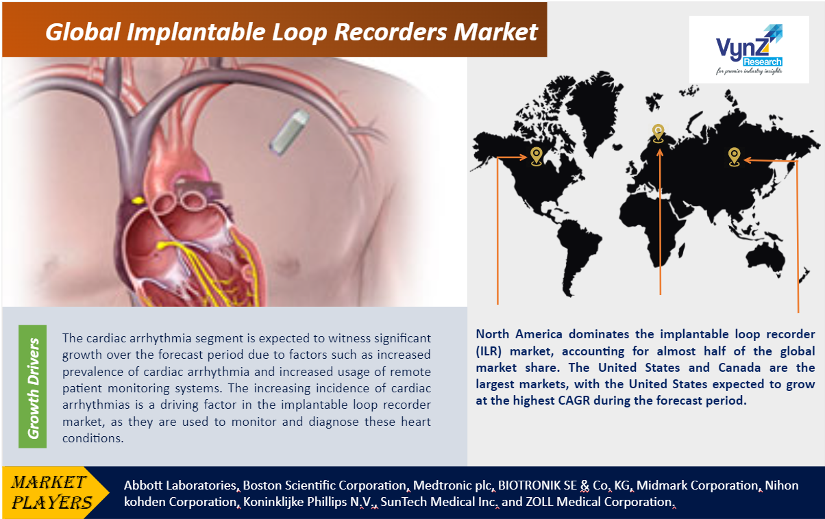 Implantable Loop Recorders Market 1 ELearning Implantable Loop Recorders Market 1 ELearning